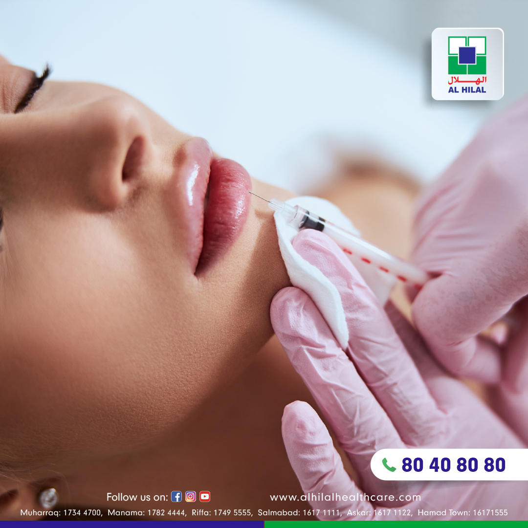 Dermal Fillers: What They Are, Types, Benefits & Side Effects What are ...